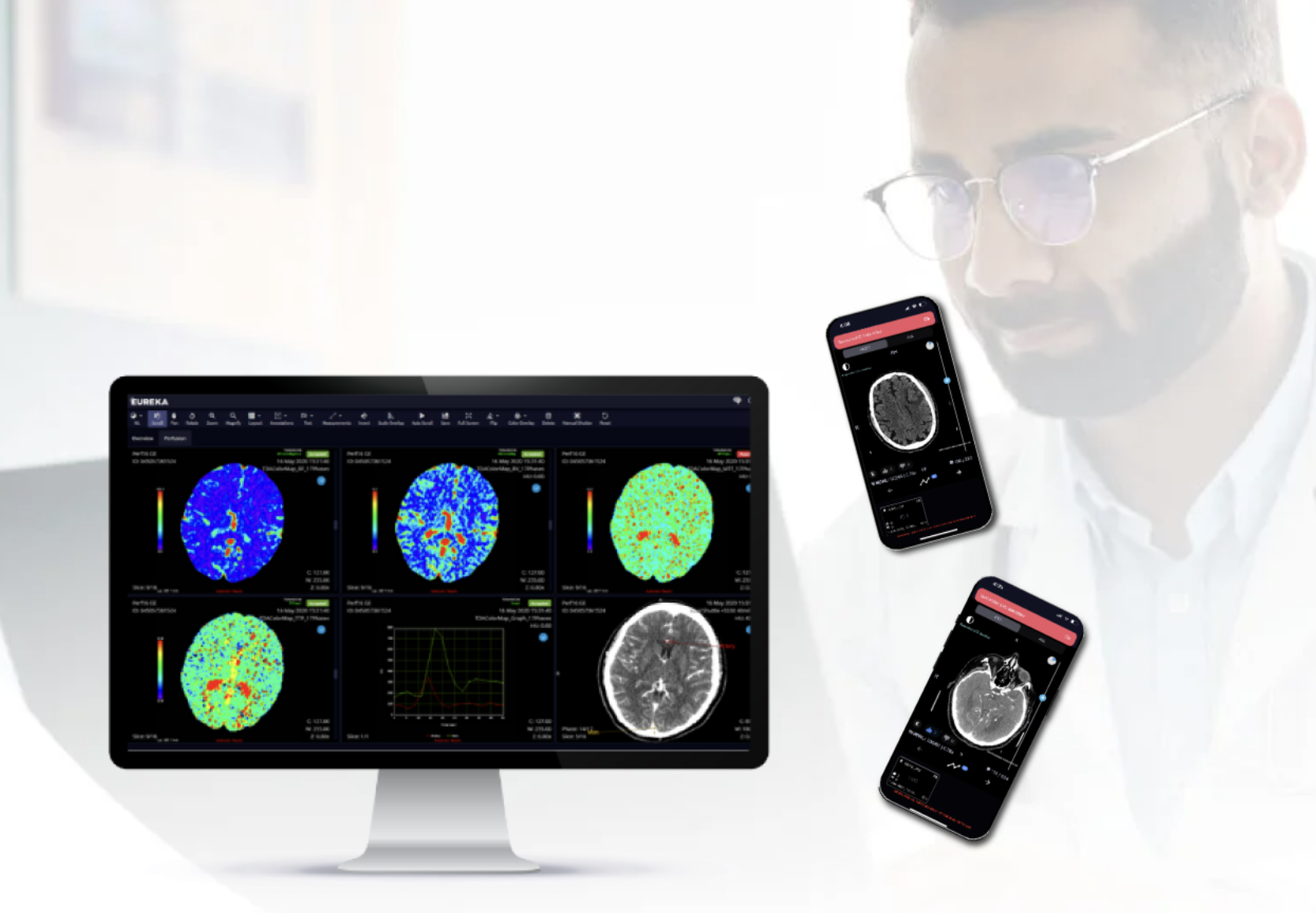 Prostate Cancer Detection with AI | Prostate Cancer Diagnosis with AI